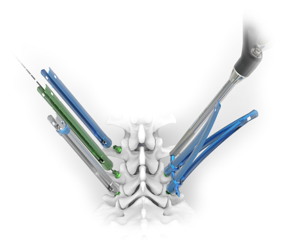 Apelo MIS - SPINEMarketGroup