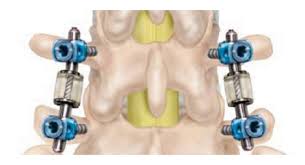 CD HORIZON® AGILE™ - SPINEMarketGroup