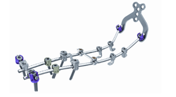 Oasys System - SPINEMarketGroup