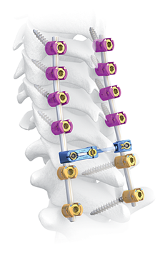 Posterior Cervical Systems Archives