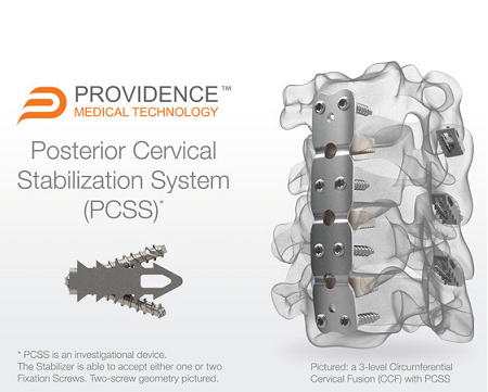 Providence Medical Technology Announces First Patient Enrollment in the ...