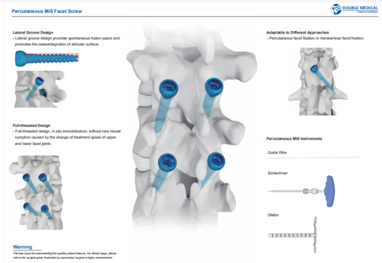 Percutaneous MIS Facet Screw.Double Medical - SPINEMarketGroup