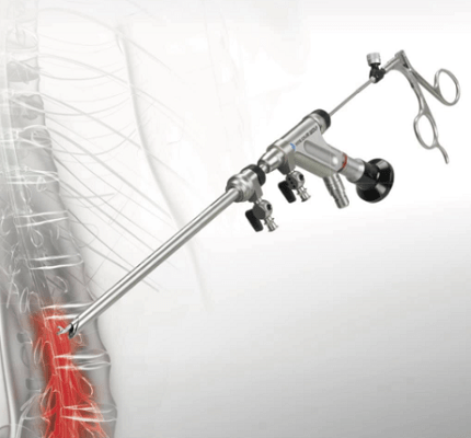 Exploring the Rise of Spinal Endoscopy: Uncovering Trends, Market ...