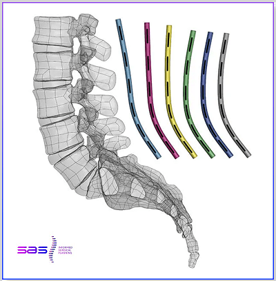 Revolutionizing Spinal Alignment: AI-Enhanced Surgical Planning ...