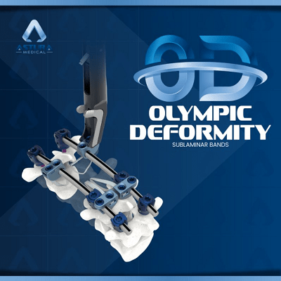 Astura Medical Unveils Advanced Sublaminar Bands System for Spinal ...
