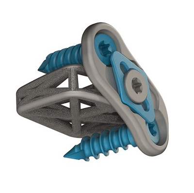 4WEB Medical Announces Commercial Launch of its Cervical Spine ...