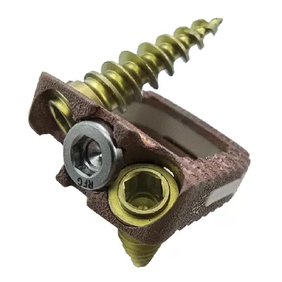 Ti/PEEK Cages with Screw Fixation in ACDF: Redmond® C Clinical Data ...